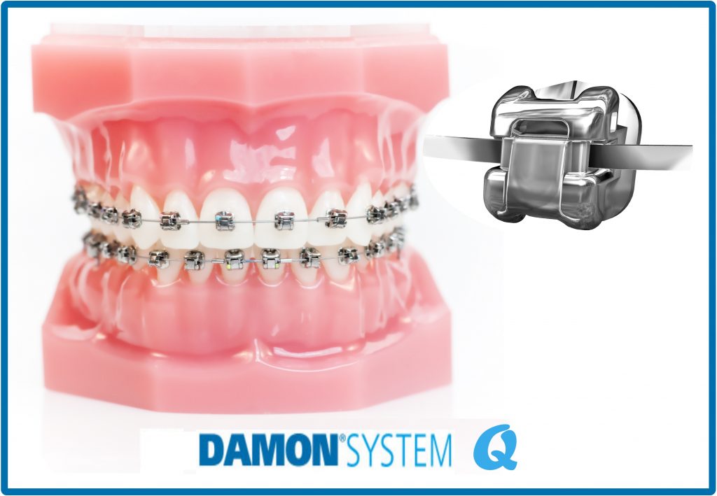 Damon Q - Dr. Dalmadi Lilian - Fogorvos Zugló